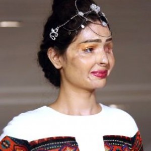 Acid Attack Survivor Models For Fashion Week - ZergNet