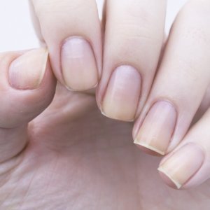 This is What's Really Making Your Nails Look Gnarly - ZergNet